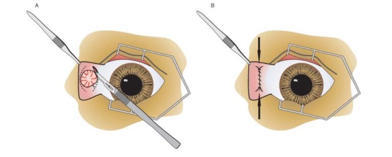 Third Eyelid Gland Prolapse in Dogs • MSPCA-Angell