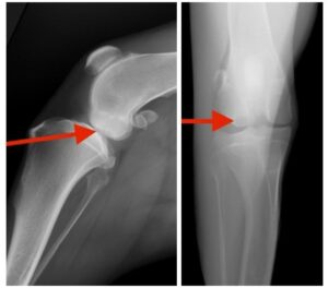 Osteochondral Autograft Transfer for Canine Stifle Osteochondrosis ...
